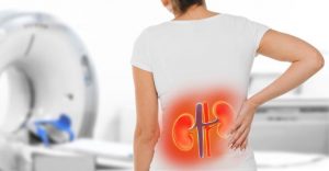 Kidney damage and disorders can result in azotemia, which comes in ...