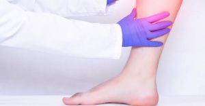 Homan’s Sign Test for DVT: What You Need to Know - Findlocal Doctors
